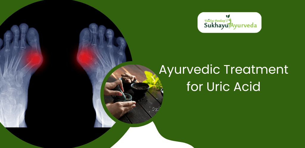 Ayurvedic Treatment for Uric Acid - Sukhayu Ayurveda